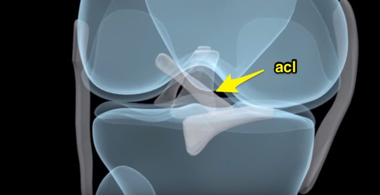 What happens in ACL Reconstruction Surgery